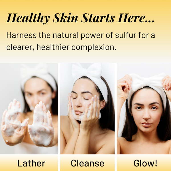 Dead Sea Minerals Active Sulphur Soap 3 Pack Jericho Marketplace